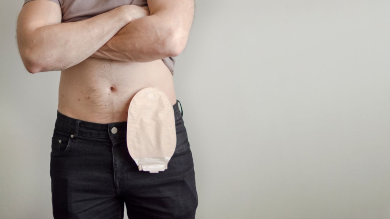 EL DÍA MUNDIAL DEL PACIENTE OSTOMIZADO SE CELEBRA EL PRIMER SÁBADO DE ...