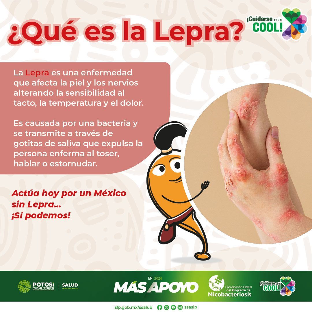 28 de enero, día mundial de lucha contra la lepra 2024 - OPINION ...